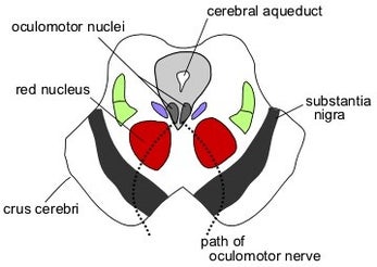 Mesencephalon / midbrain / Impact of brain injury per brain area ...