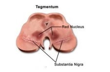 Mesencephalon / midbrain / Impact of brain injury per brain area ...