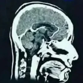 Brain scans explained / Information | Braininjury-explanation.com