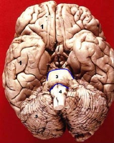 Mesencephalon / midbrain / Impact of brain injury per brain area ...