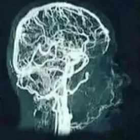 Brain scans explained / Information | Braininjury-explanation.com