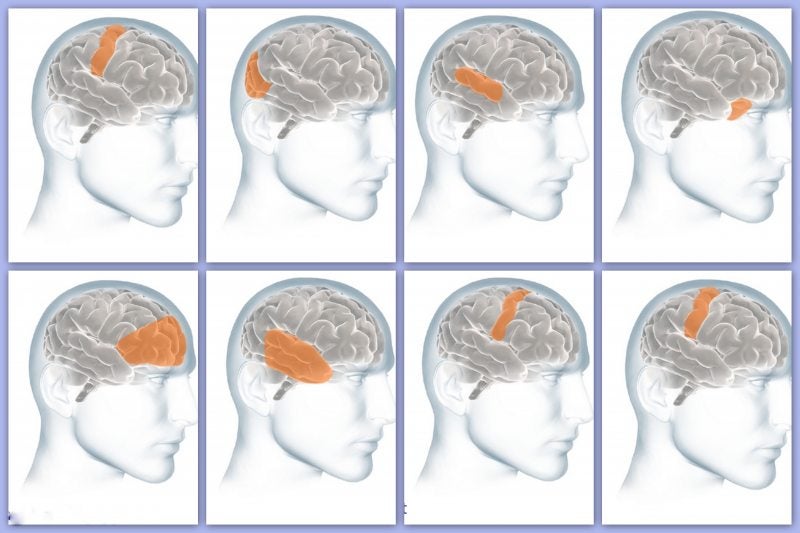 Impact per brain area / General Information about Brain Injury ...