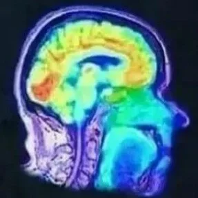 Brain scans explained / Information | Braininjury-explanation.com