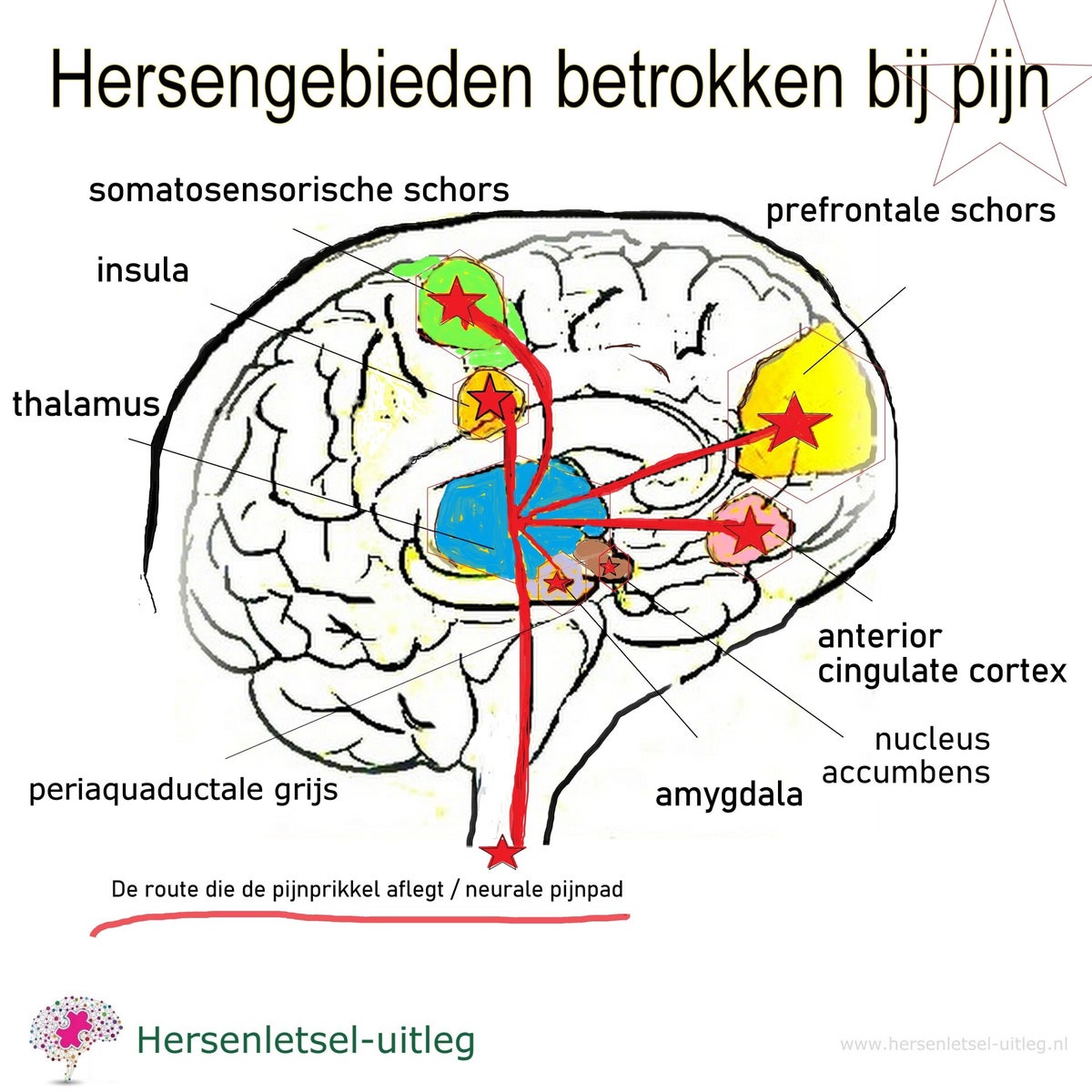 Pijn / Lichamelijke gevolgen / Gevolgen | Hersenletsel-uitleg.nl