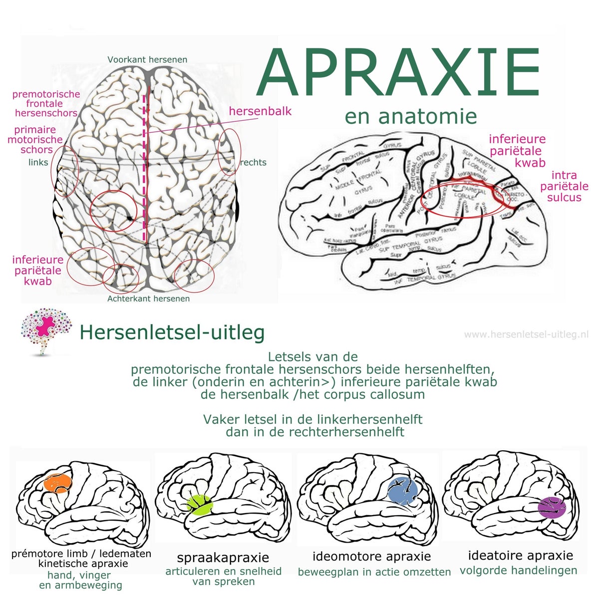Apraxie / Lichamelijke gevolgen / Gevolgen | Hersenletsel-uitleg.nl