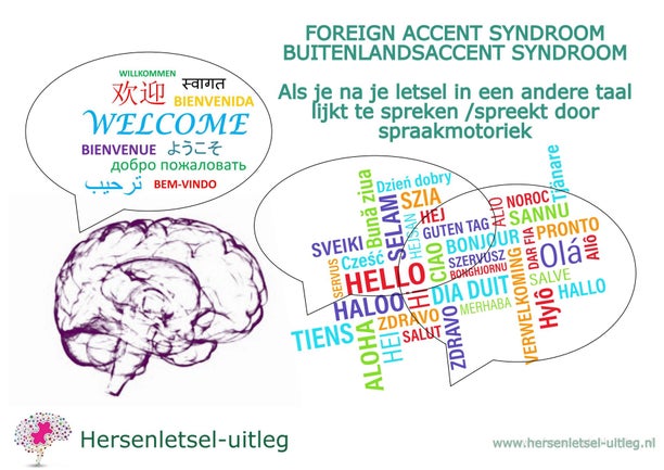 Foreign accent syndrome FAS