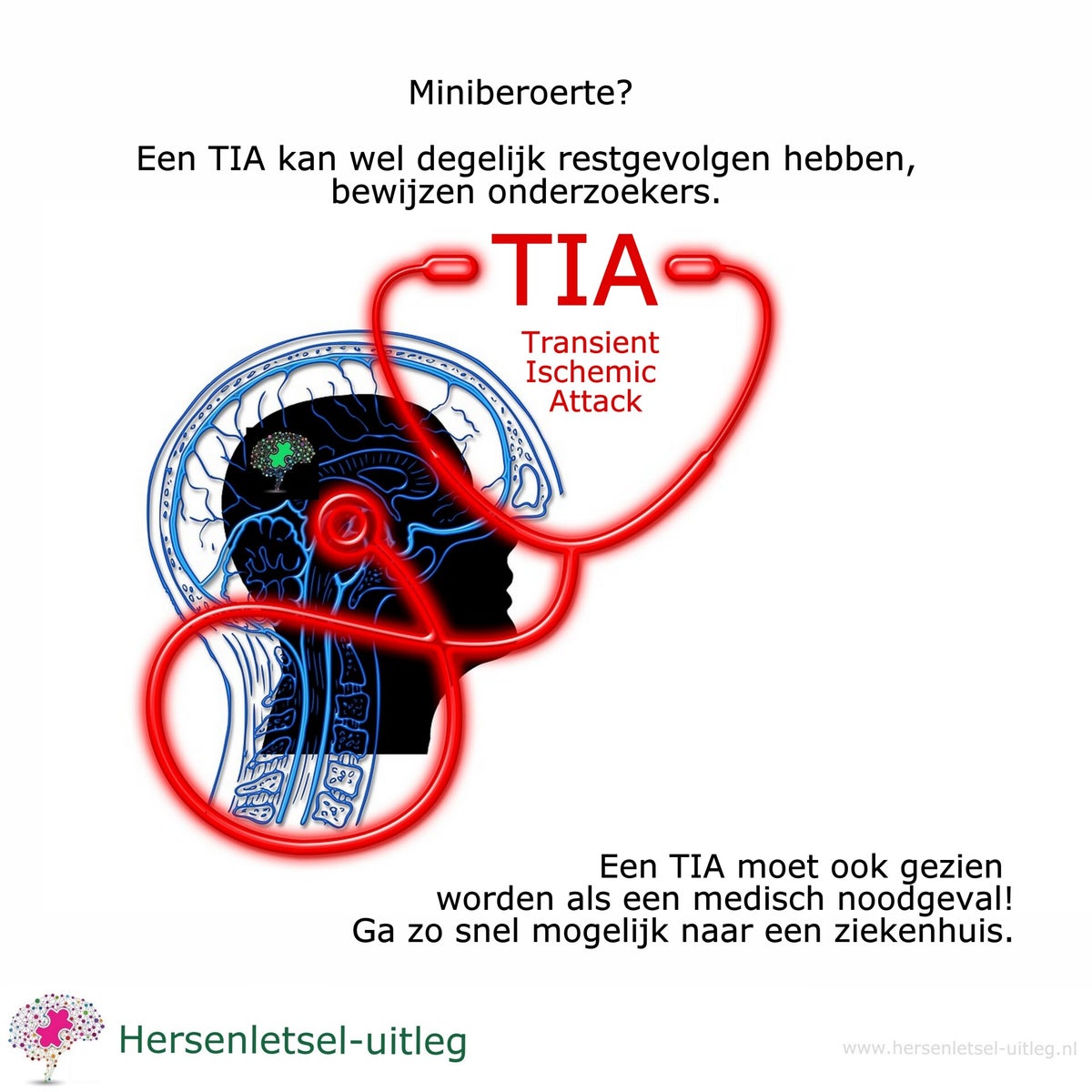 TIA / Beroerte CVA / Soorten hersenletsel hersenaandoeningen | Hersenletsel-uitleg.nl