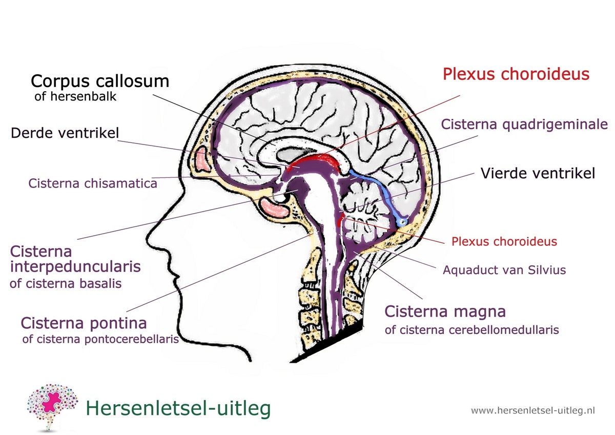 Sub Arachnoïdale Bloeding SAB / Hersenbloeding / Beroerte CVA / Soorten ...