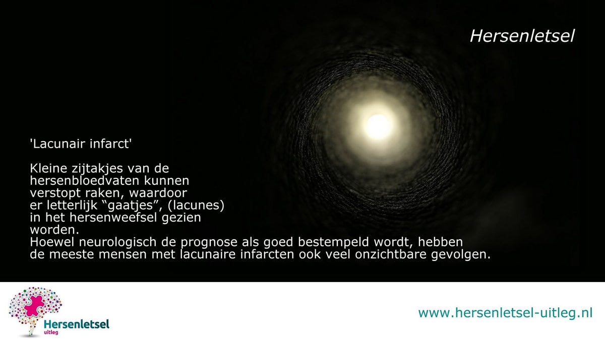 Lacunair infarct / Herseninfarct / Beroerte CVA / Soorten hersenletsel ...