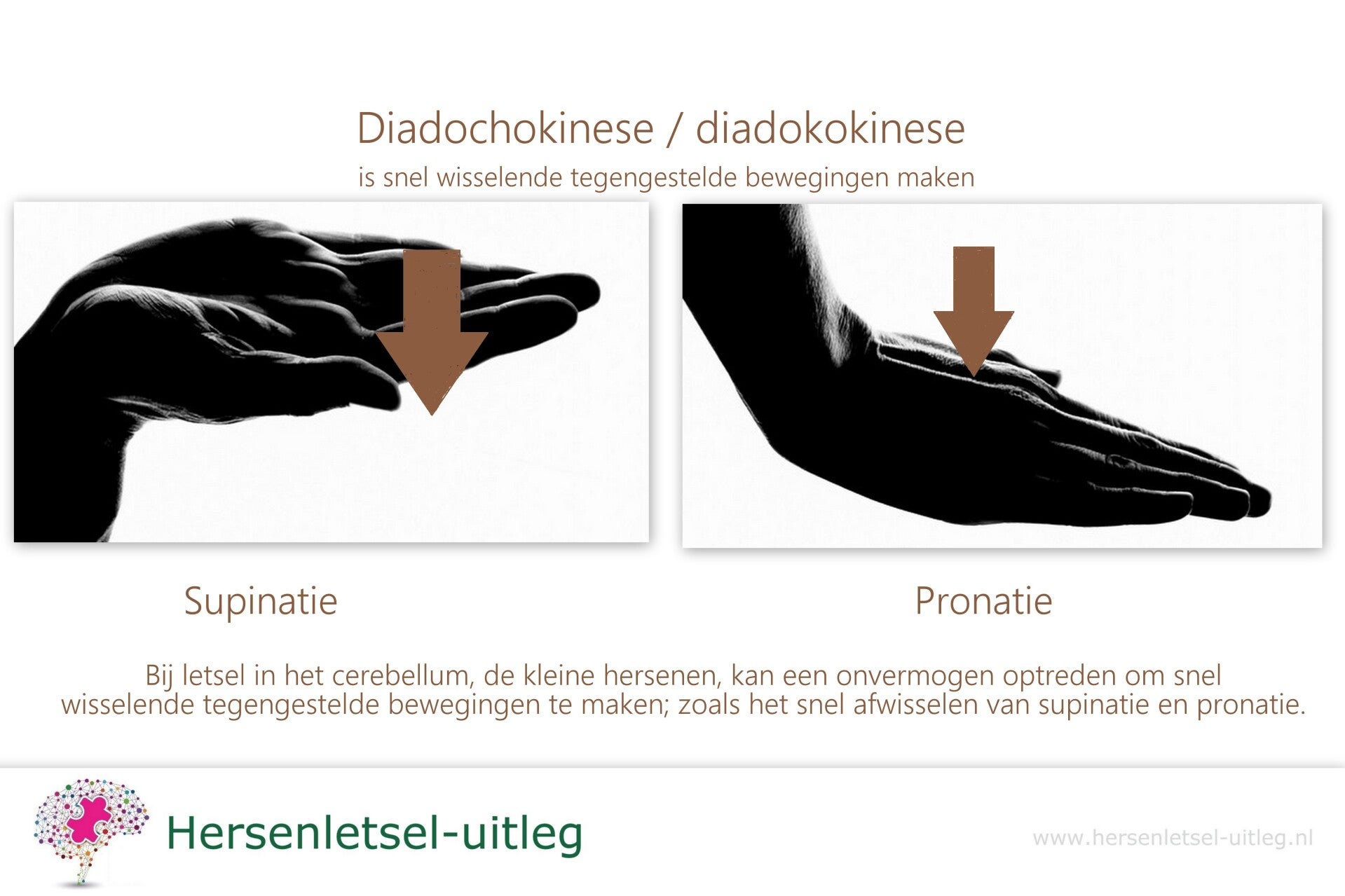 Cerebellum / Kleine hersenen / Gevolgen per hersengebied | Hersenletsel ...