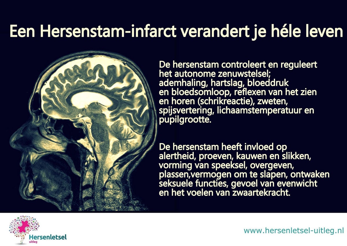 Hersenstam / Gevolgen per hersengebied | Hersenletsel-uitleg.nl