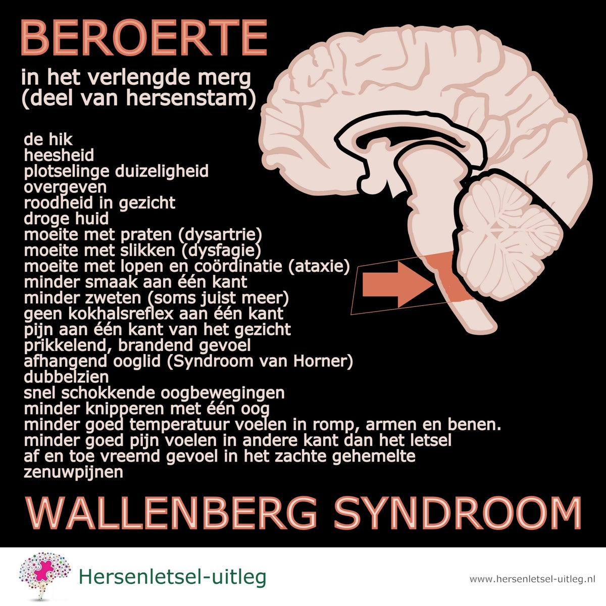 Wallenberg Syndroom / Herseninfarct / Beroerte CVA / Soorten hersenletsel hersenaandoeningen ...