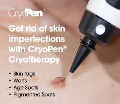 Cryopen / Behandelingen | Degroenehuid