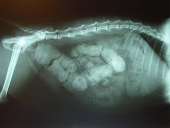 Obstipatie | Bedcompli