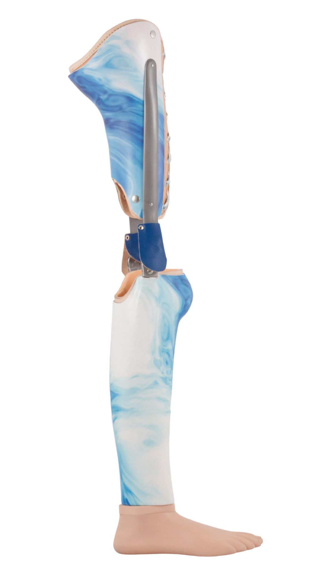 Beenprothesen | Rijndam Orthopedietechniek