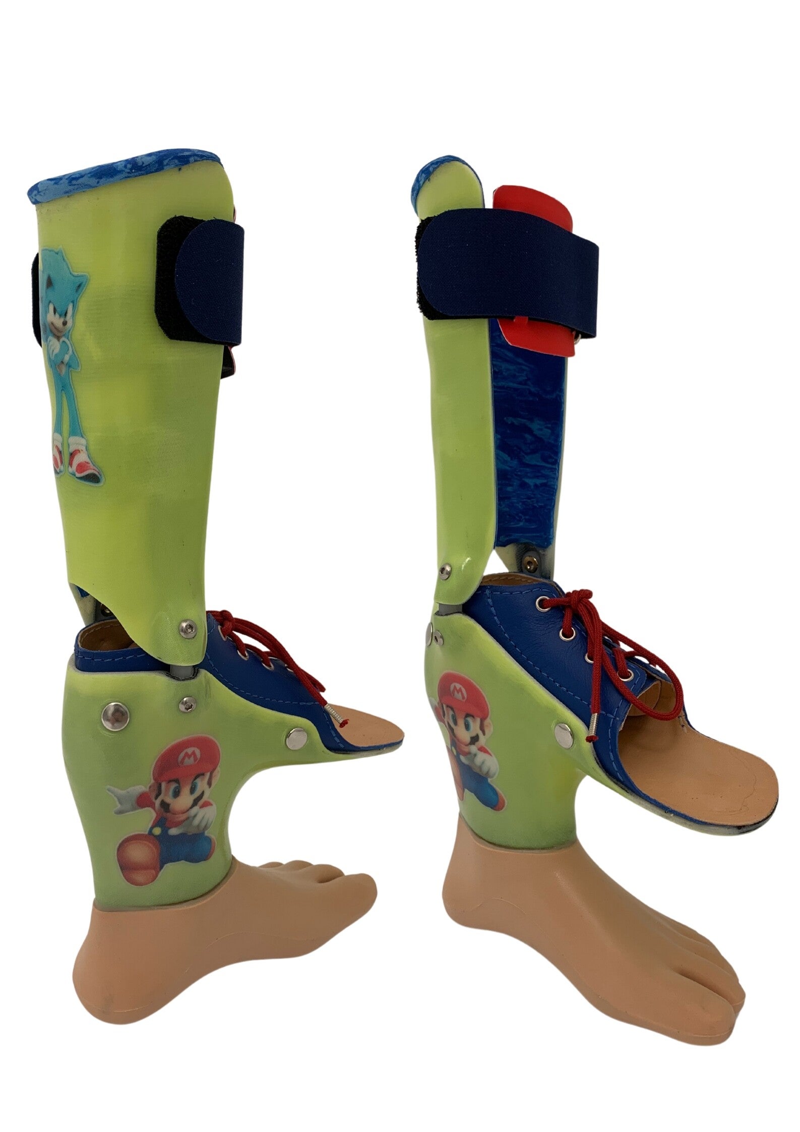 Beenprothesen | Rijndam Orthopedietechniek