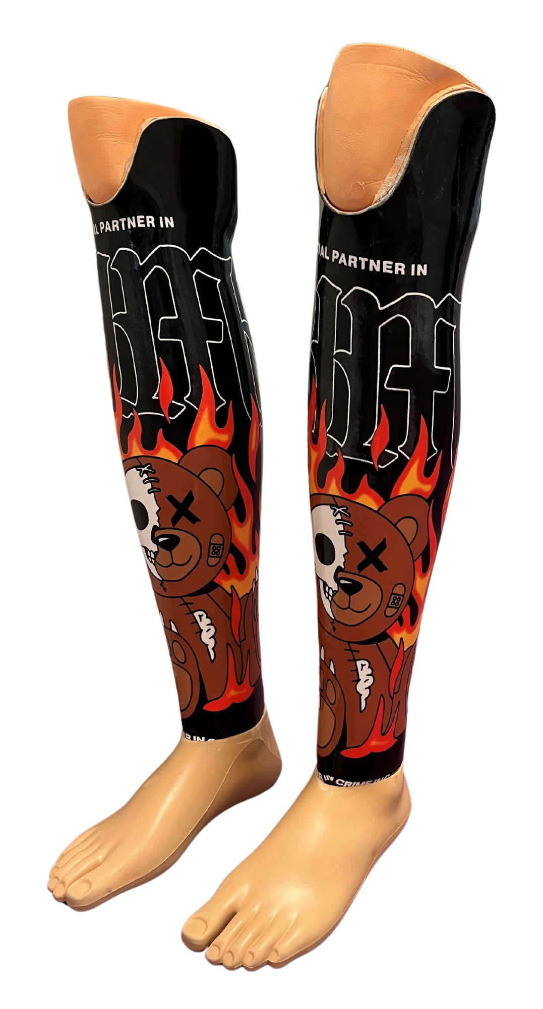 Beenprothesen | Rijndam Orthopedietechniek