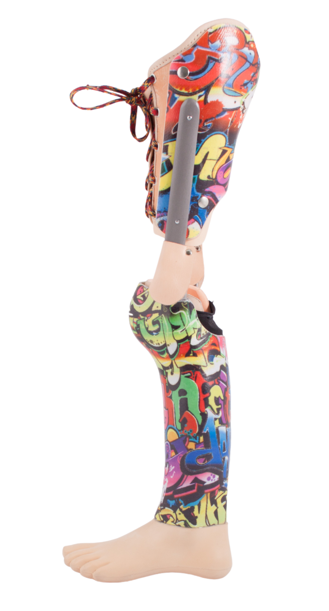 Beenprothesen | Rijndam Orthopedietechniek