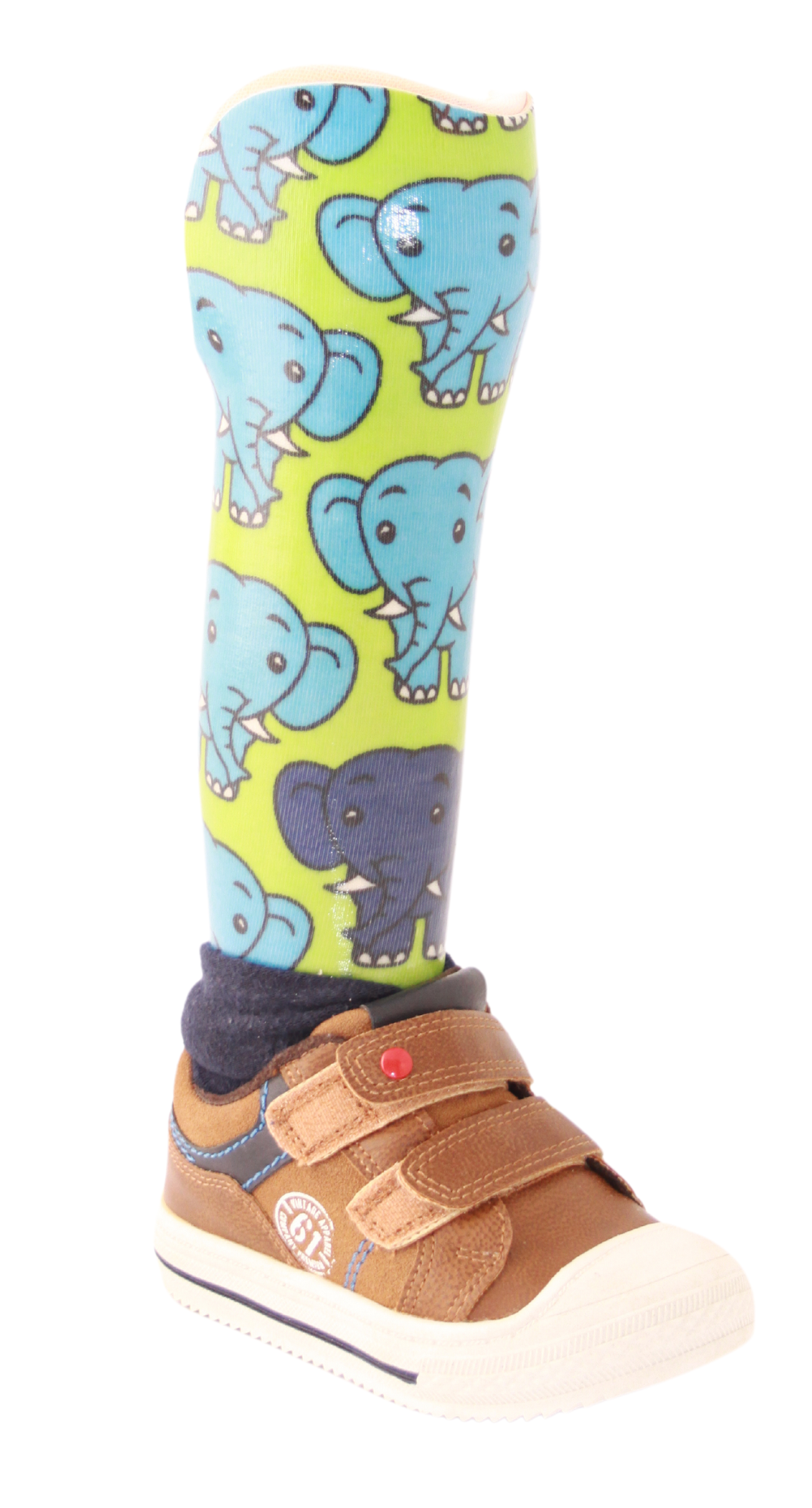 Beenprothesen | Rijndam Orthopedietechniek