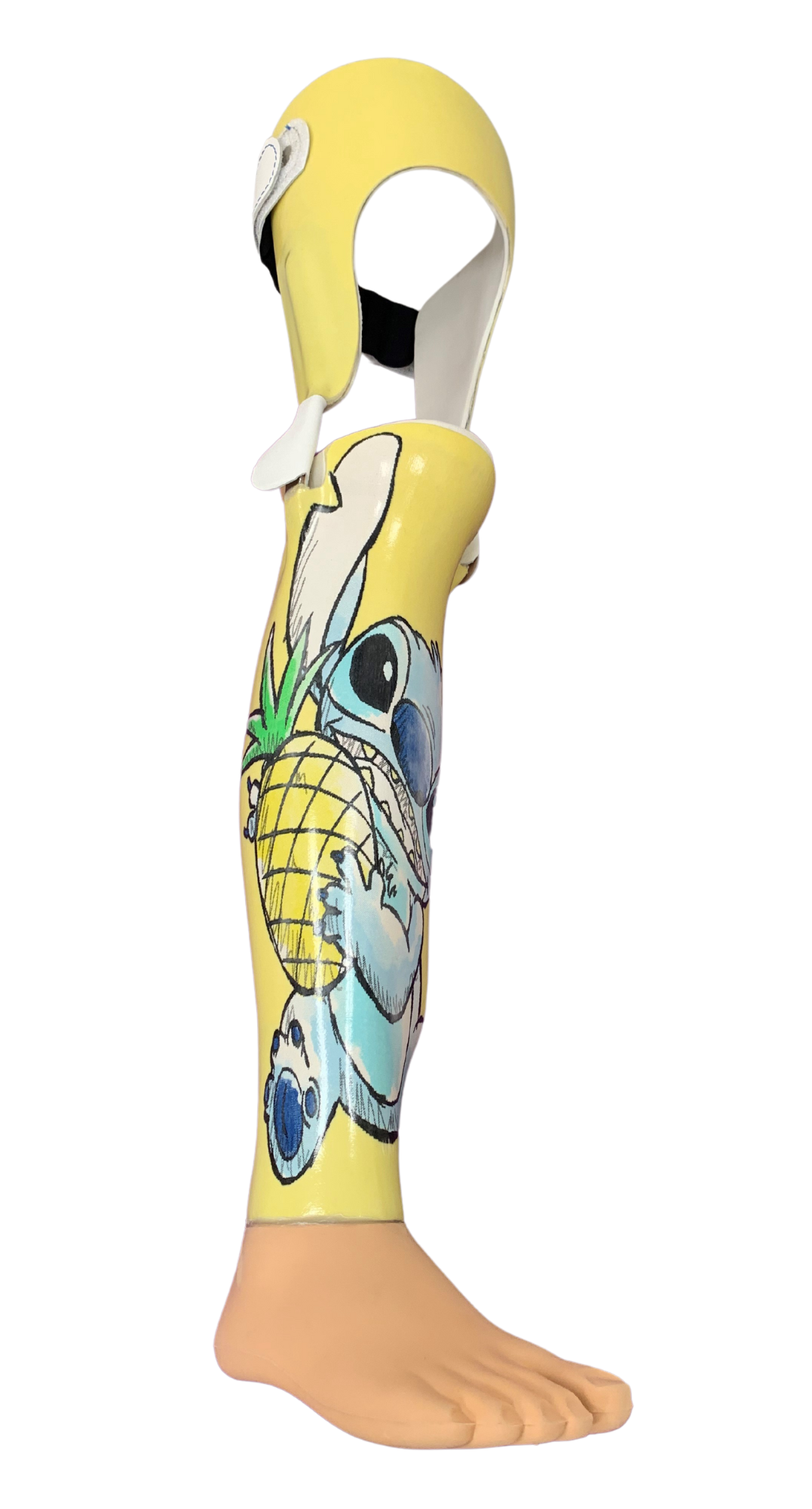 Beenprothesen | Rijndam Orthopedietechniek