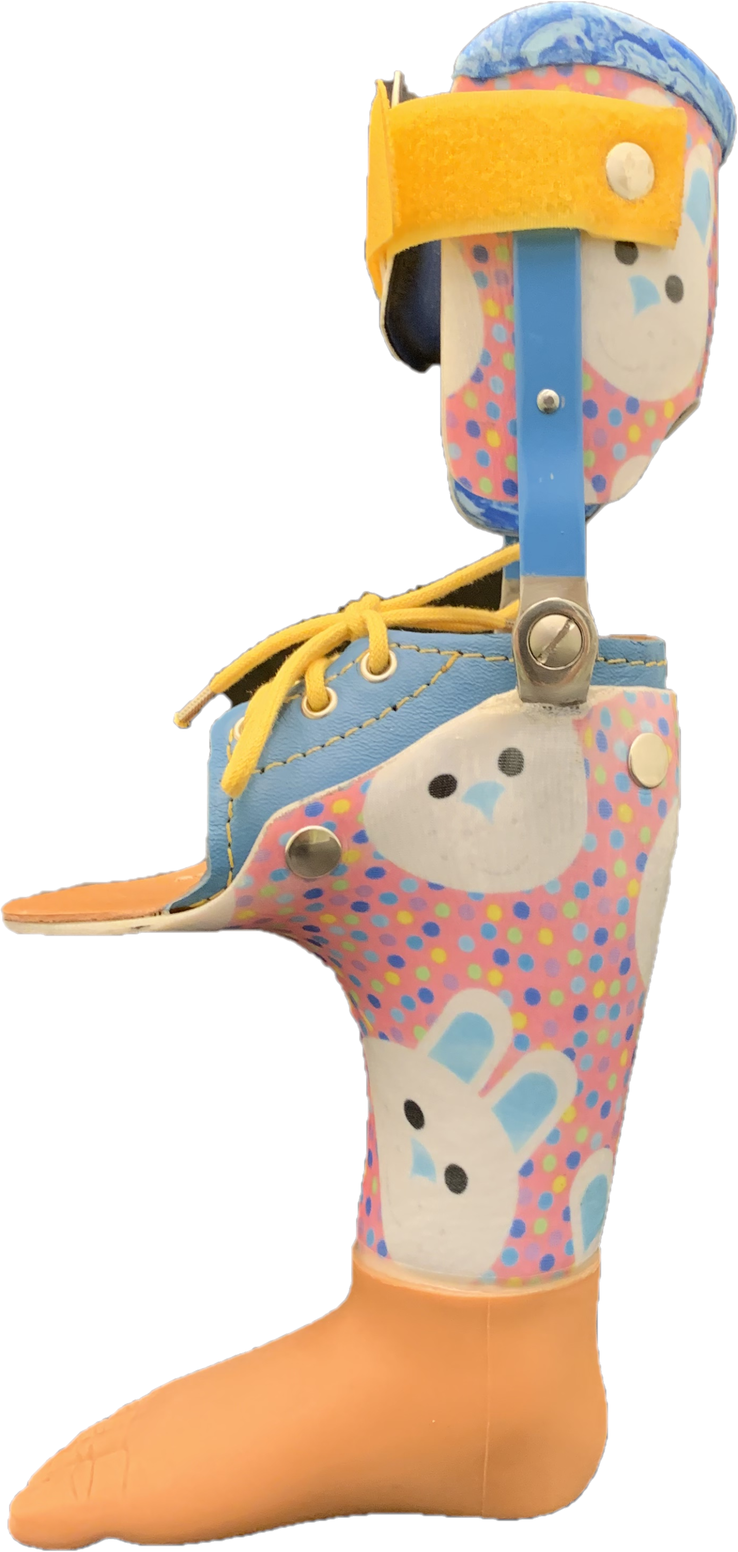 Beenprothesen | Rijndam Orthopedietechniek