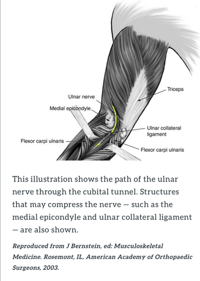 Cubital Tunnel Syndrome and Cubital Tunnel Release / Elbow/Wrist/Hand ...