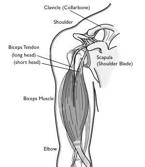 Biceps Tendonitis and Arthroscopic Tenodesis Surgery / Shoulder ...