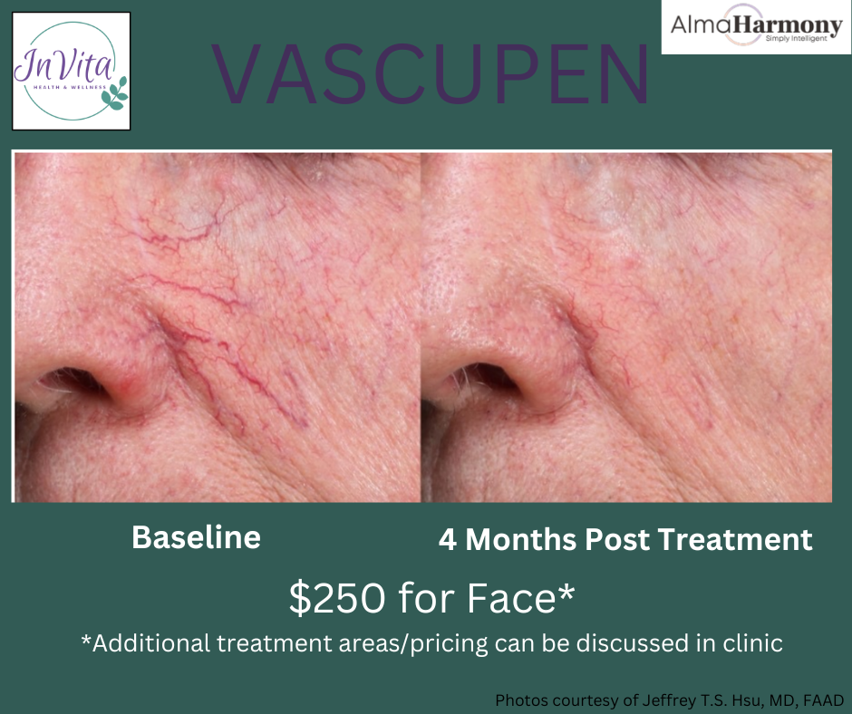 Skin Revitalization Treatments | InVita Health & Wellness