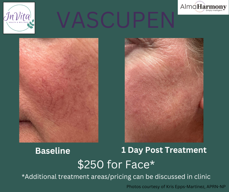 Skin Revitalization Treatments | InVita Health & Wellness