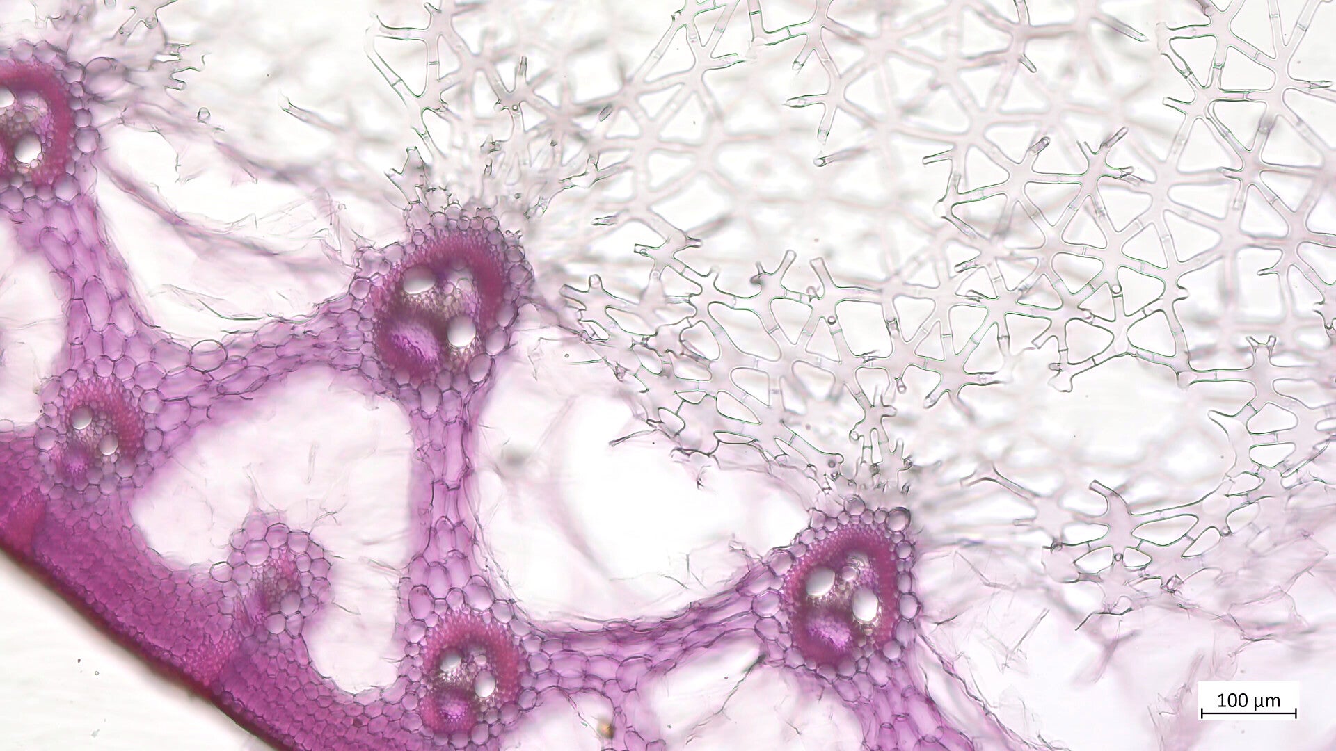 Les parenchymes / Tissus fondamentaux / Histologie des Trachéophytes ...
