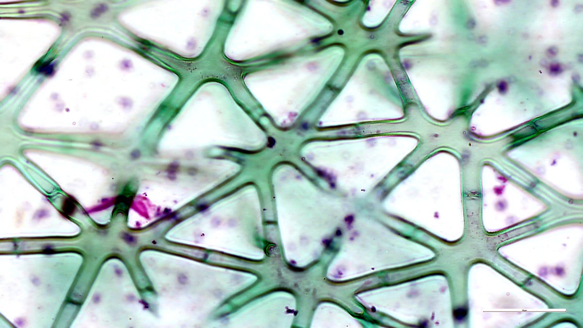 Les parenchymes / Tissus fondamentaux / Histologie des Trachéophytes ...