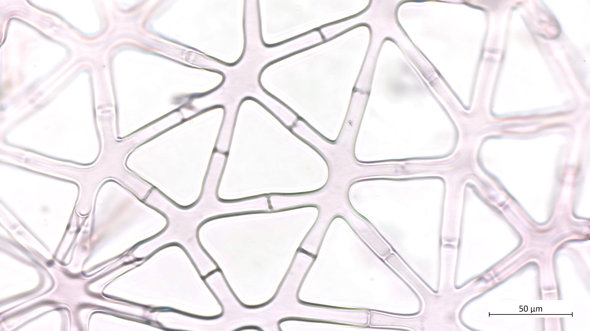 Les parenchymes / Tissus fondamentaux / Histologie des Trachéophytes ...