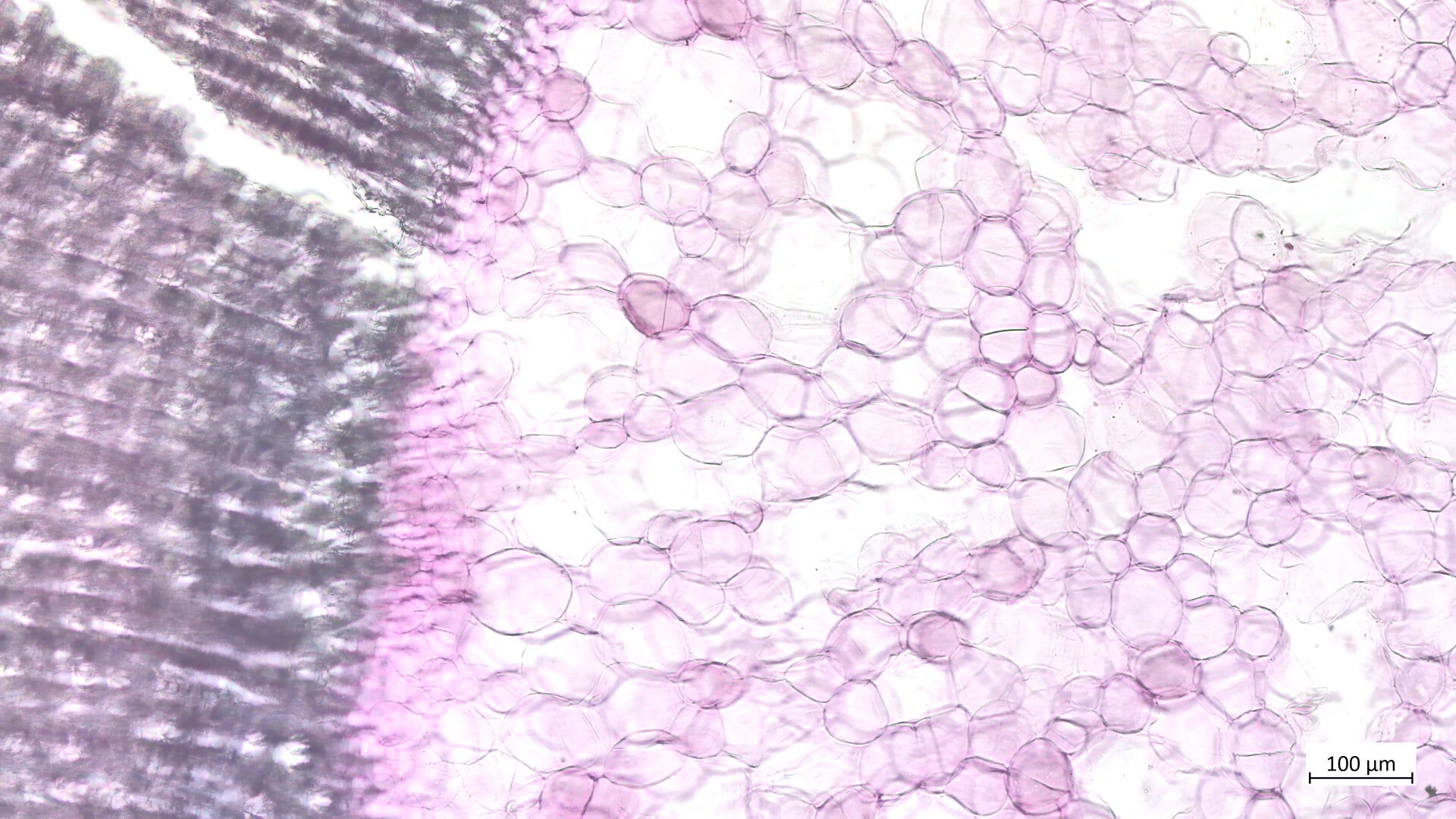 Les parenchymes / Tissus fondamentaux / Histologie des Trachéophytes ...