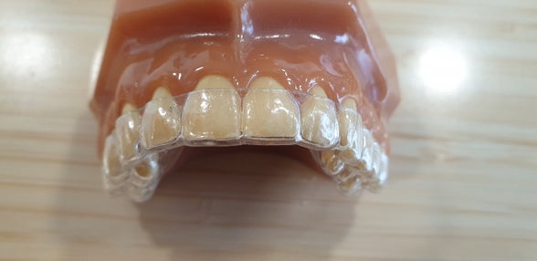Retentie beugels / Soorten beugels / Alles over beugels | Orthodontist ...
