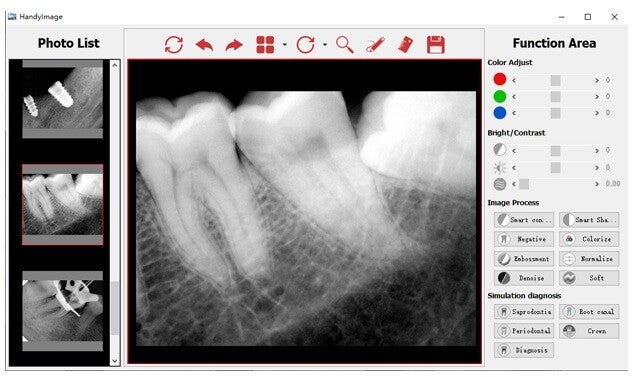 HANDY - HDR 500/HDR 600 - Digital X-ray (CMOS) Sensor | Al-Mahdi ...
