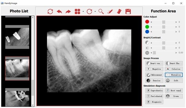 HANDY - Phosphor Plate (PSP) Scanner - HDS 500 | Al-Mahdi - Dental Supplies