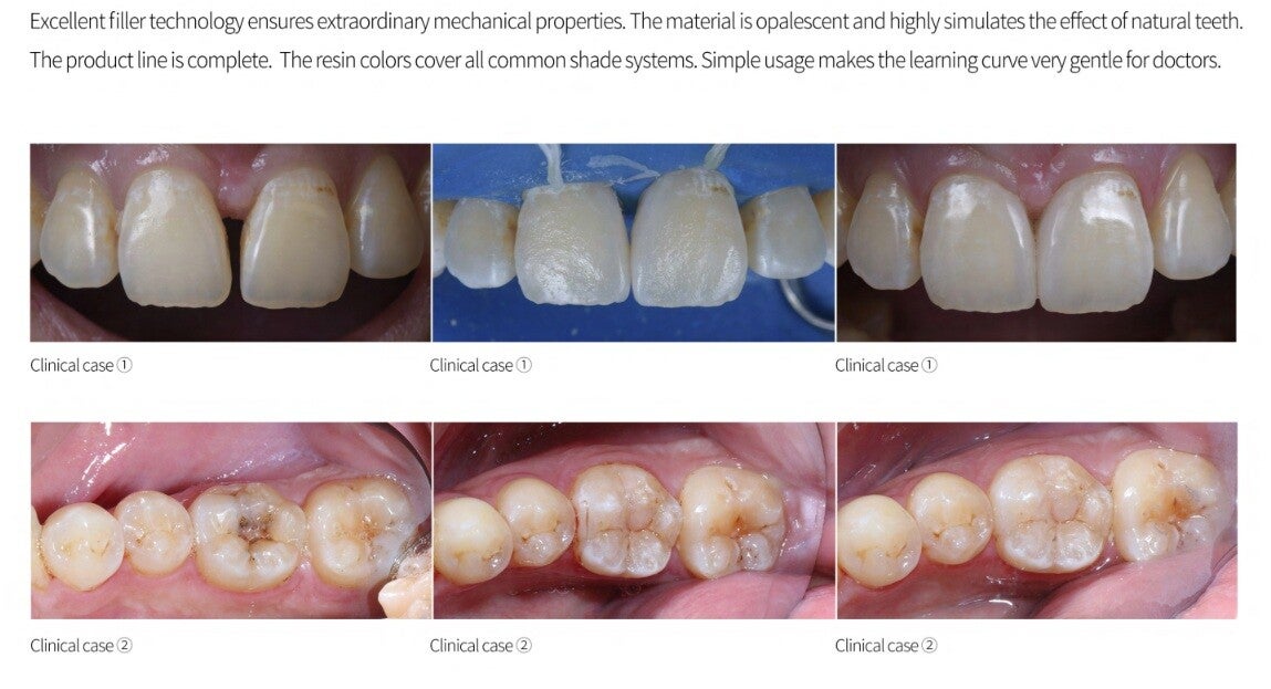 Nanofil® Z250 Universal Composite (Capsules) - 15x 0.3g | Al-Mahdi ...