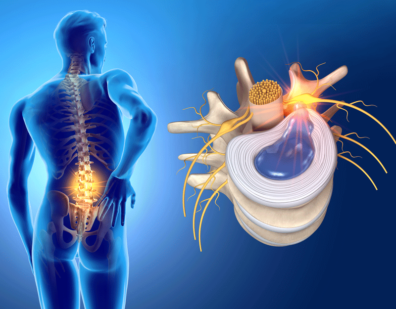 Manuele therapie bij schouderklachten