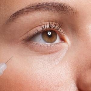 Traangoot fillers: vanaf € 330,- | ANC Clinics