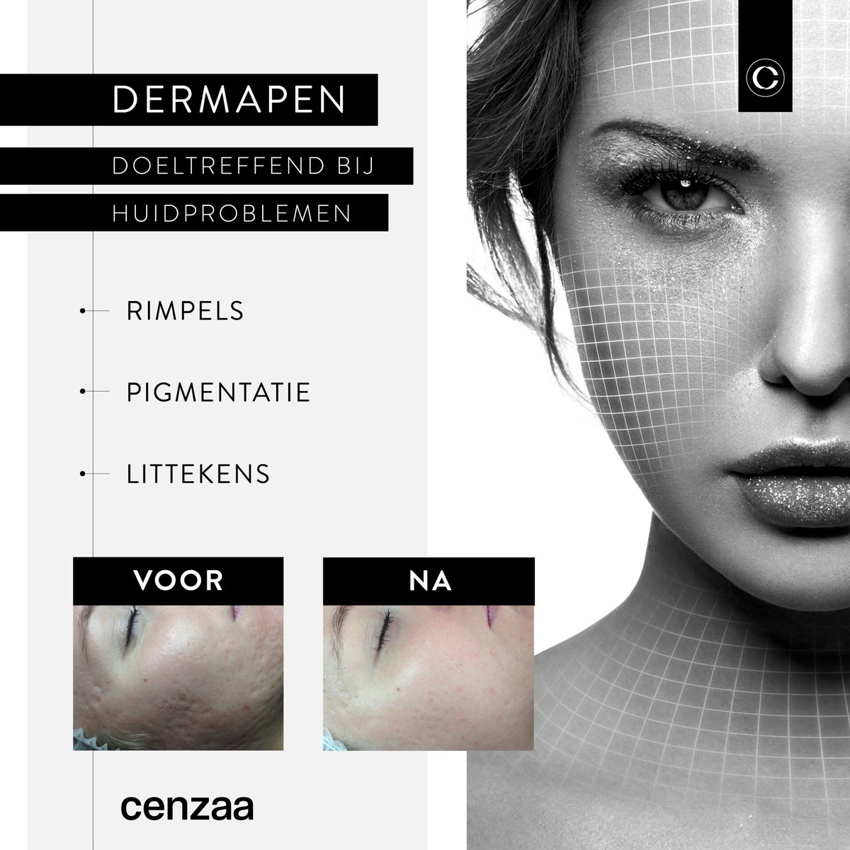 Huidverbeterende behandelingen / Behandelingen | zo-puur.nl