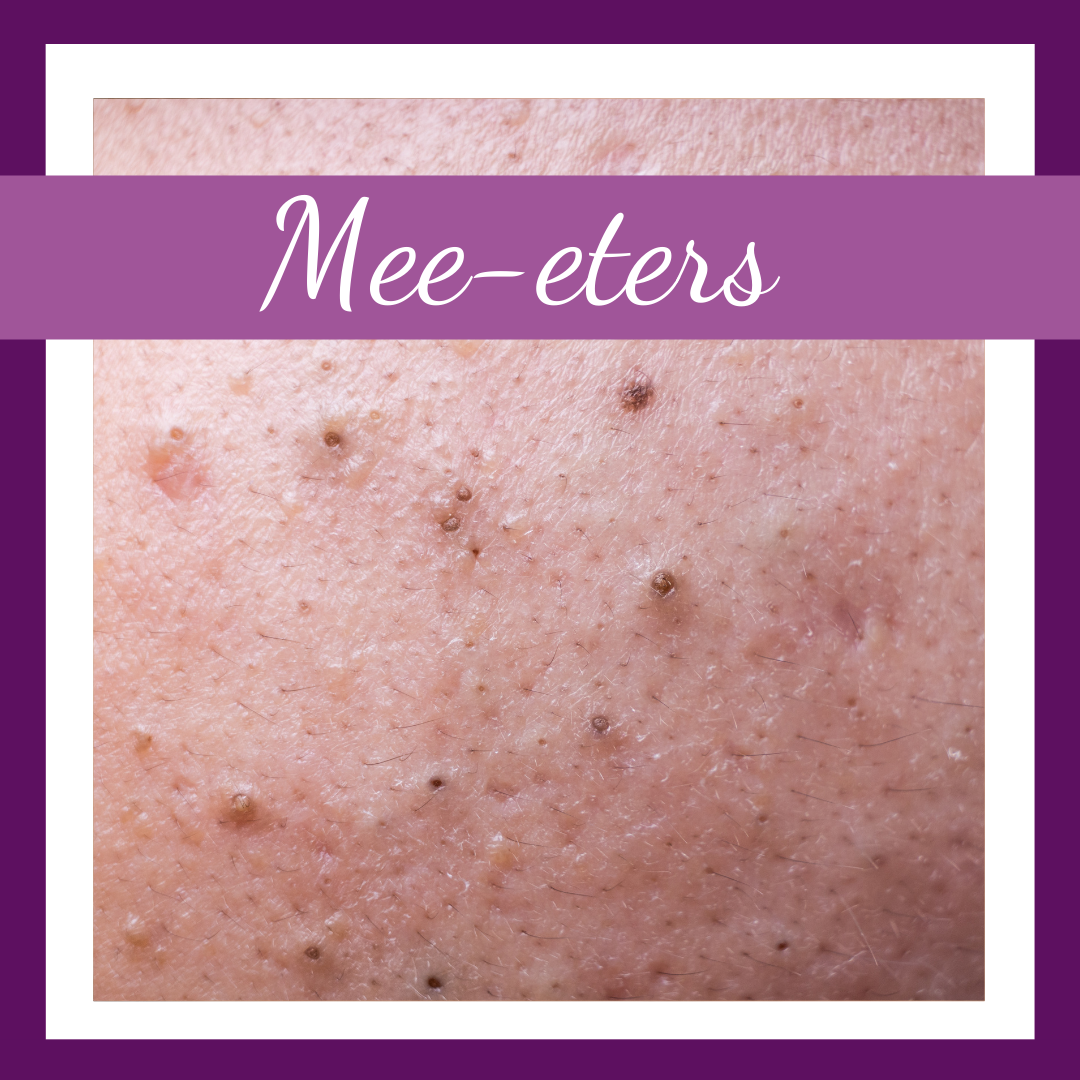 Huidproblemen | Huidinstituut Agnes