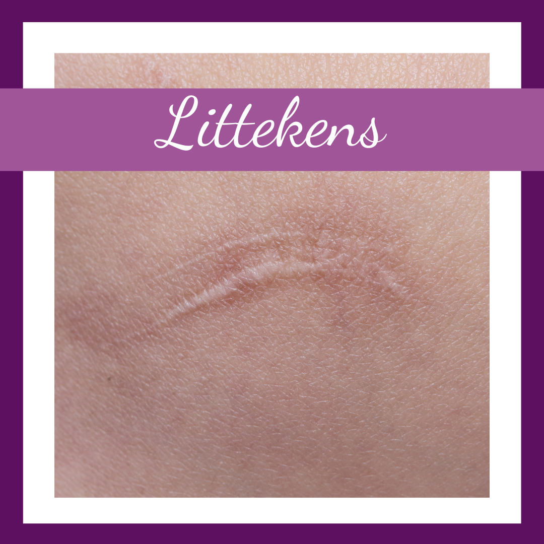 Diversen huidproblemen / Huidproblemen | Huidinstituut Agnes