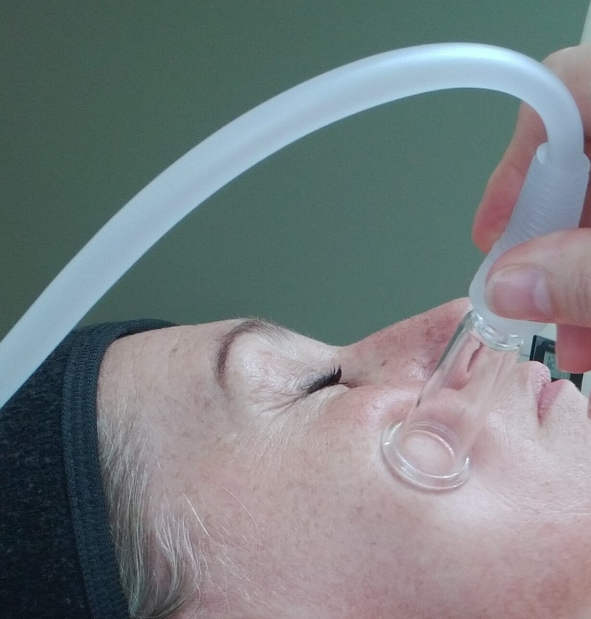 FACE CUPPING | FACIAL CUPPING