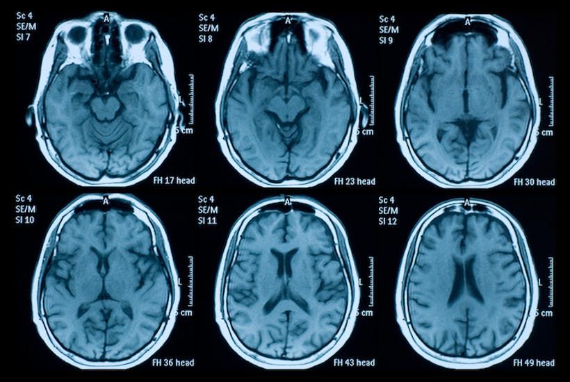 Nadelen | mri-scan.nl