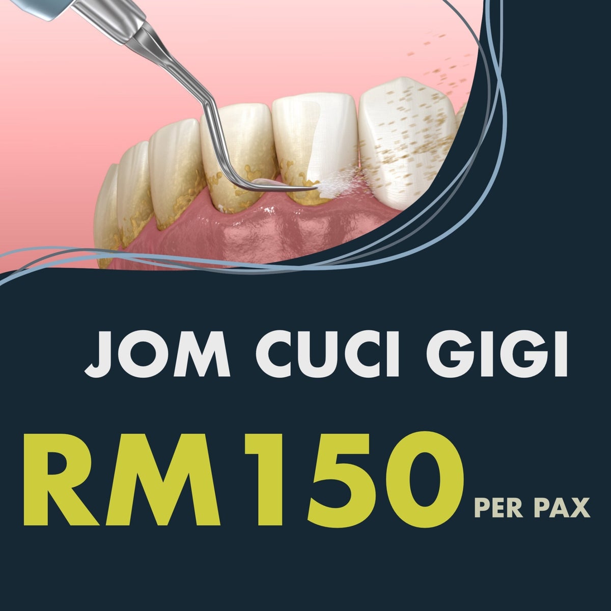 Flat Rate Scaling RM 150 at Ampang!