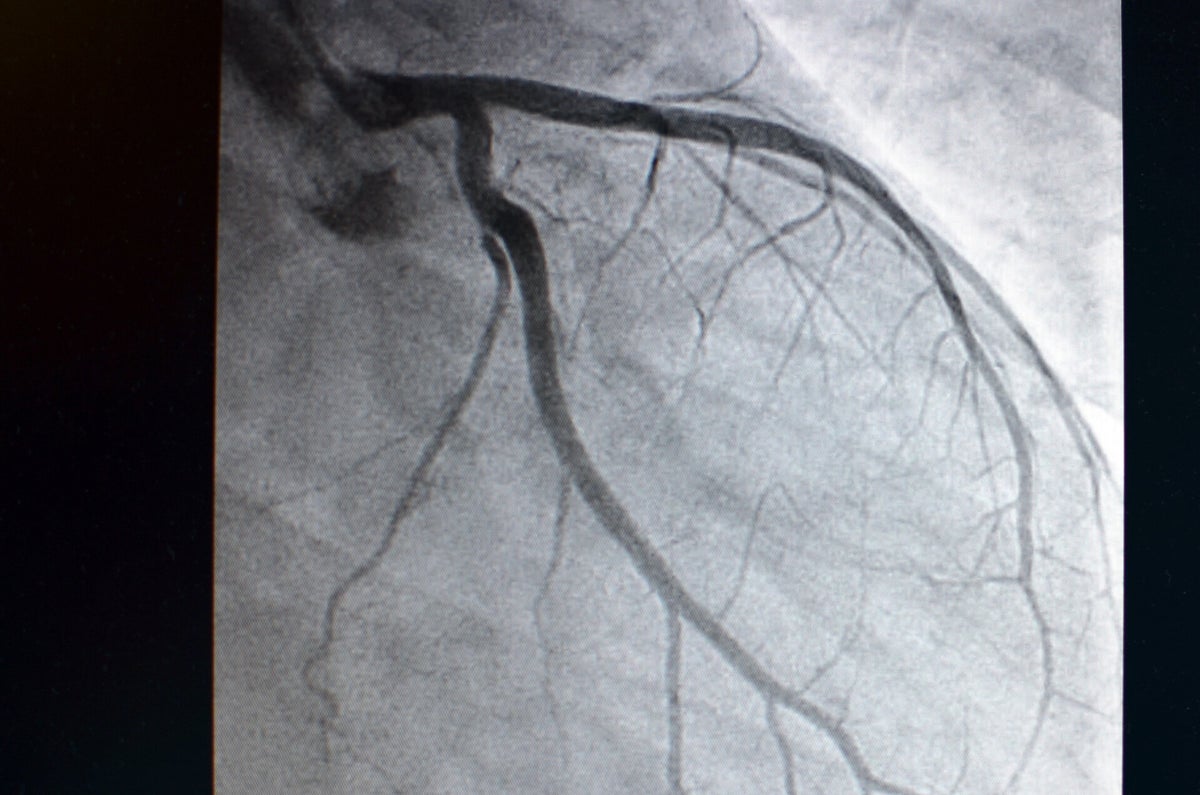 Onderzoek-Coronarografie / Patiënten-Onderzoeken | Hartcentrum Ieper