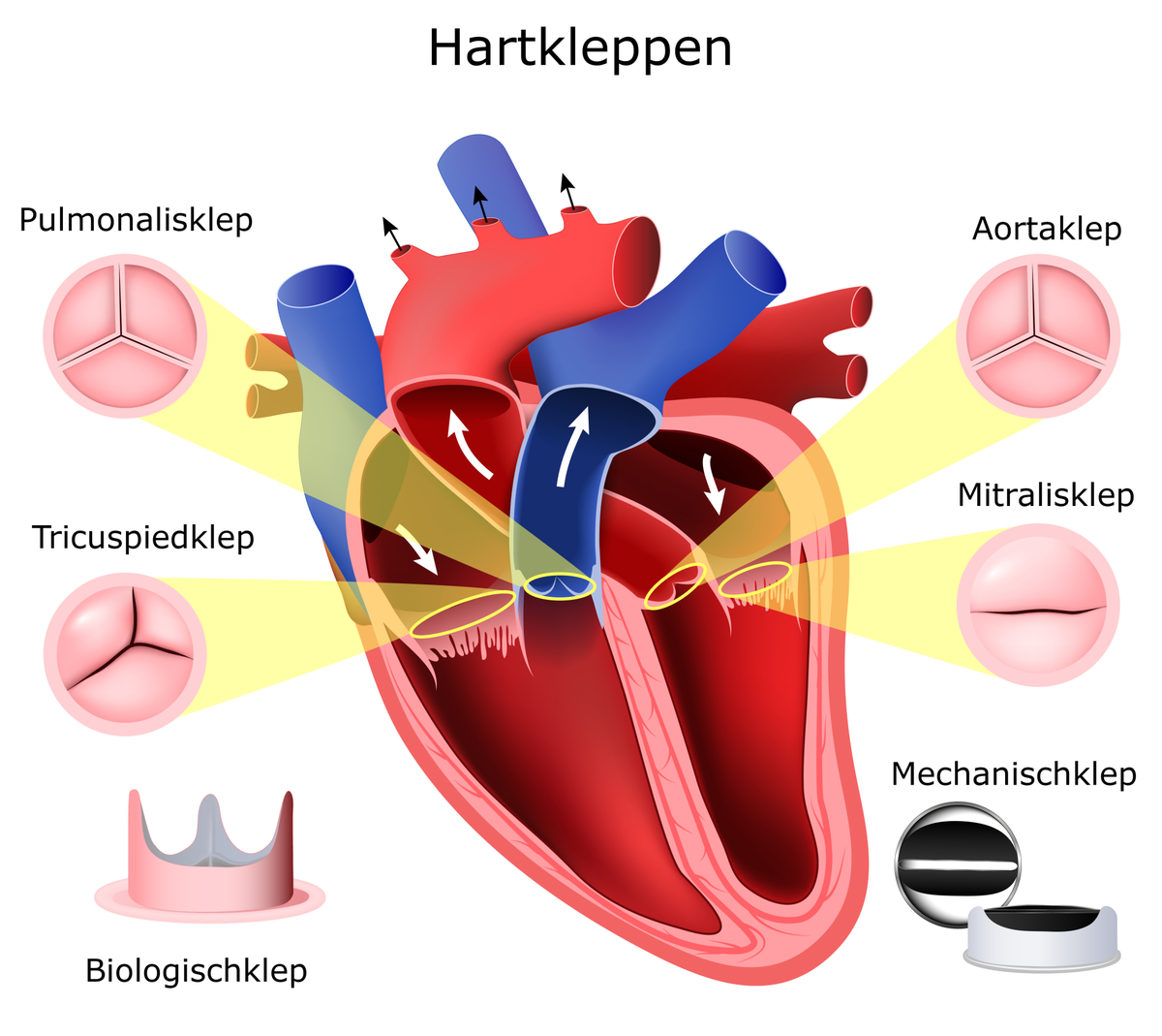 Hartziekten-Hartklepafwijkingen / Patiënten-Hartziekten | Hartcentrum Ieper